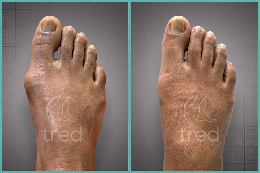 Tred Foot and Ankle Care