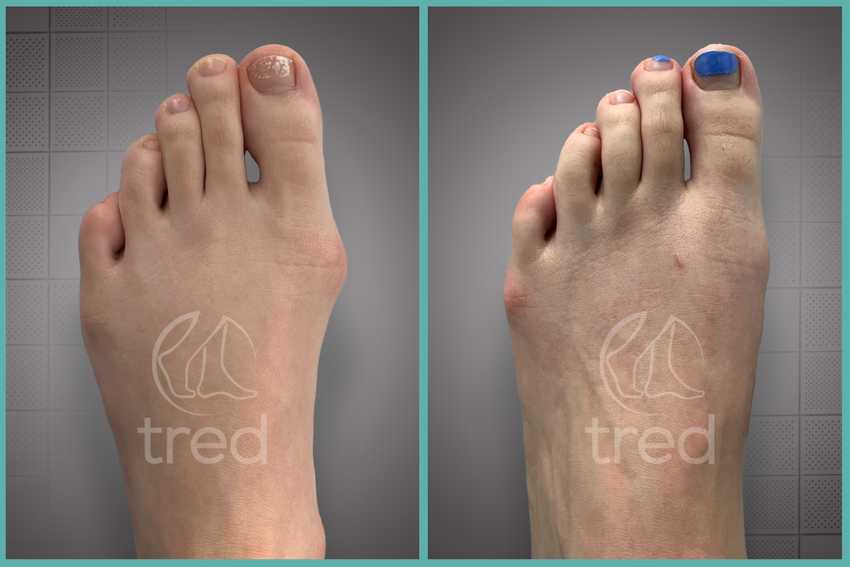 Tred Foot and Ankle Care