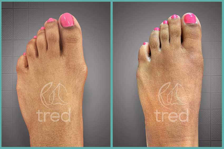 Tred Foot and Ankle Care