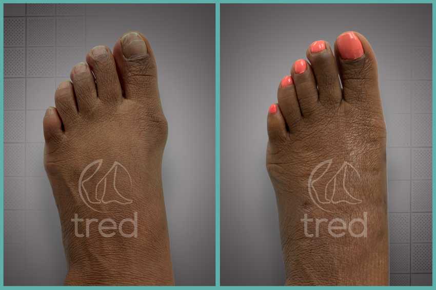 Tred Foot and Ankle Care