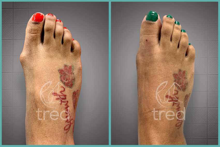 Tred Foot and Ankle Care