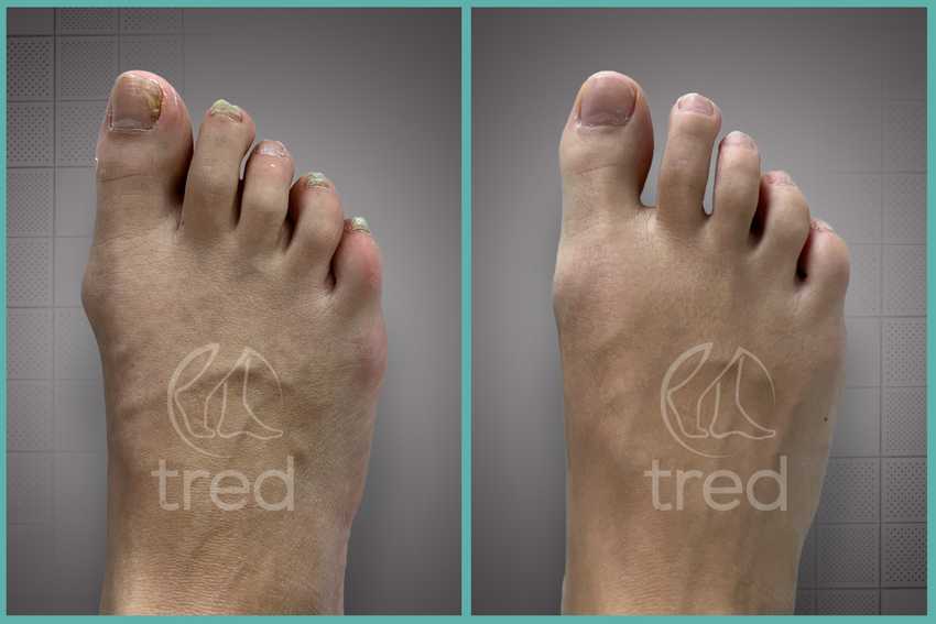 Tred Foot and Ankle Care