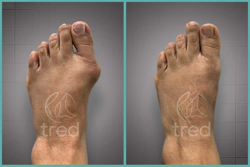 Tred Foot and Ankle Care