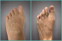 Tred Foot and Ankle Care