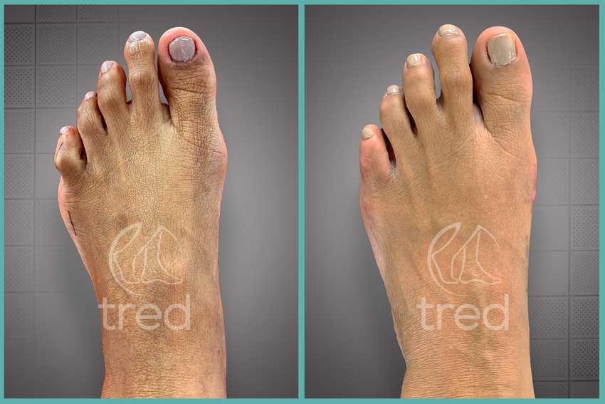 Tred Foot and Ankle Care
