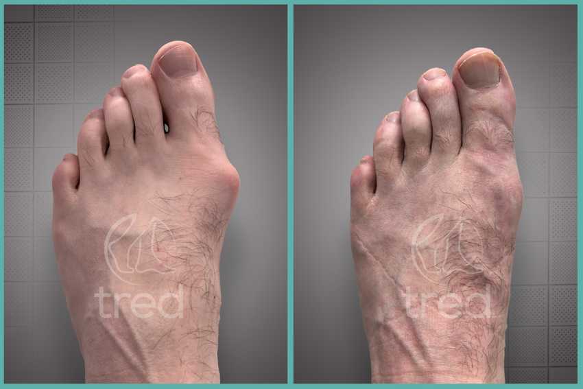 Tred Foot and Ankle Care