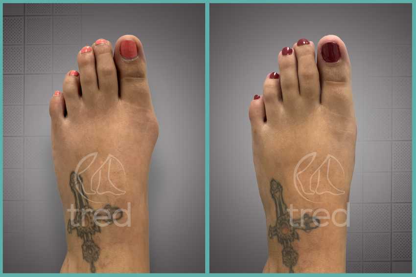 Tred Foot and Ankle Care